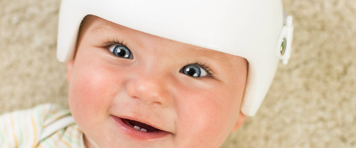 CRANIOfORM - Spéc. en déformations de la tête positionnelles